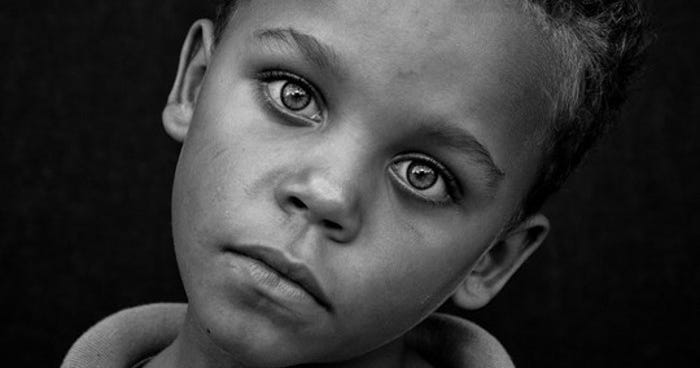 The Miracle of Sight - cataract surgery | Paper Poetry
