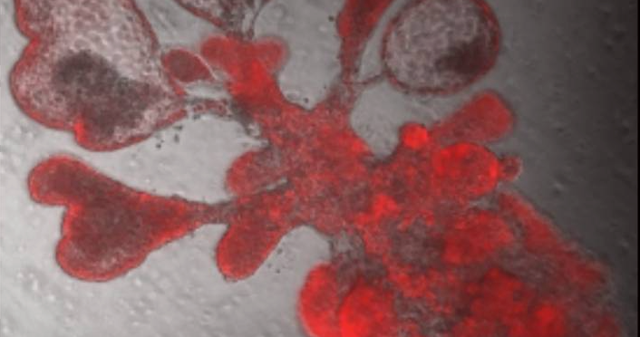 These Mini Lungs in a Dish Are Helping Scientists Study the Coronavirus ...