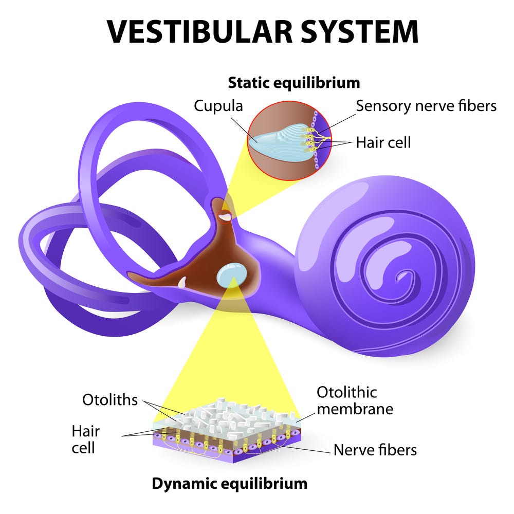 Vestibular neuritis radiology. Vestibular neuritis… | by Sagar Rajkuwar ...