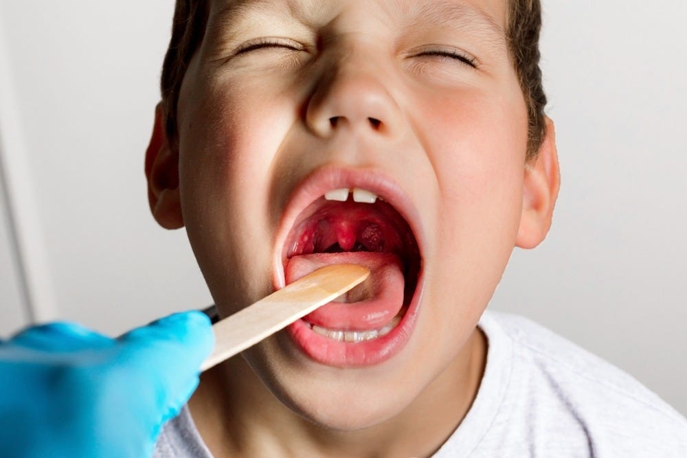 Tonsil Surgery / Tonsillectomy. Understanding Tonsil Surgery /… | by ...
