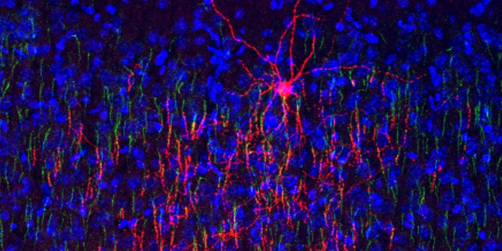 Hunting the elusive axo-axonic cell | by eLife | Brains and Behaviour ...