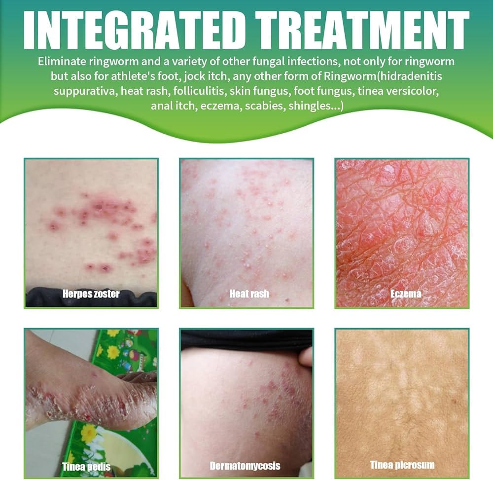 boil vs herpes | by Orville brewer | Jun, 2024 | Medium