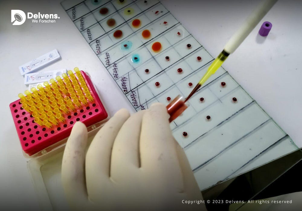 PCR/RT Market Competitive Landscape 2028: Abbott, Thermo Fisher, Merck ...
