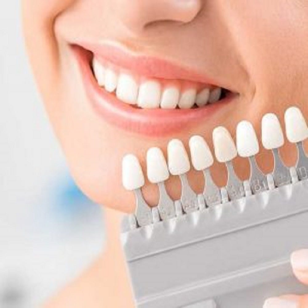 Smile Plus Homestead | Tooth Replacement in Homestead - Smile Plus ...