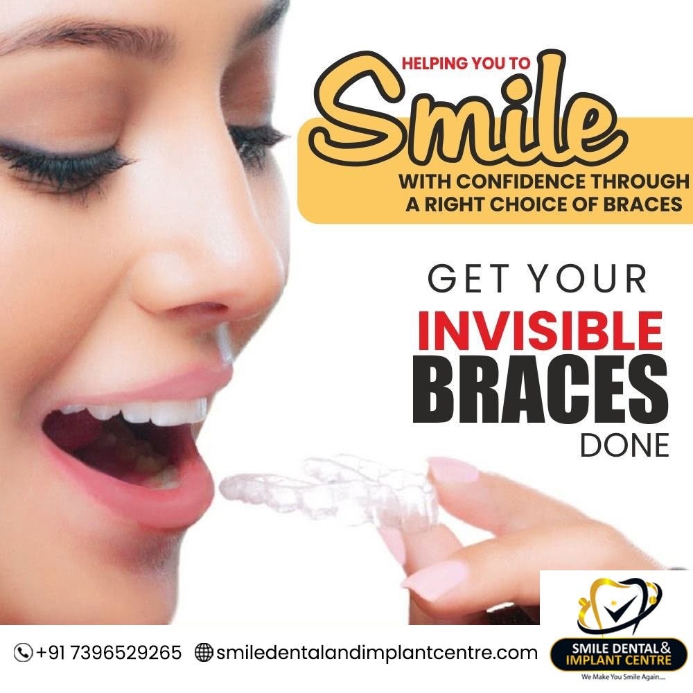 Achieve Your Dream Smile with Affordable Invisalign Teeth Aligners in Sainikpuri, Secunderabad ...