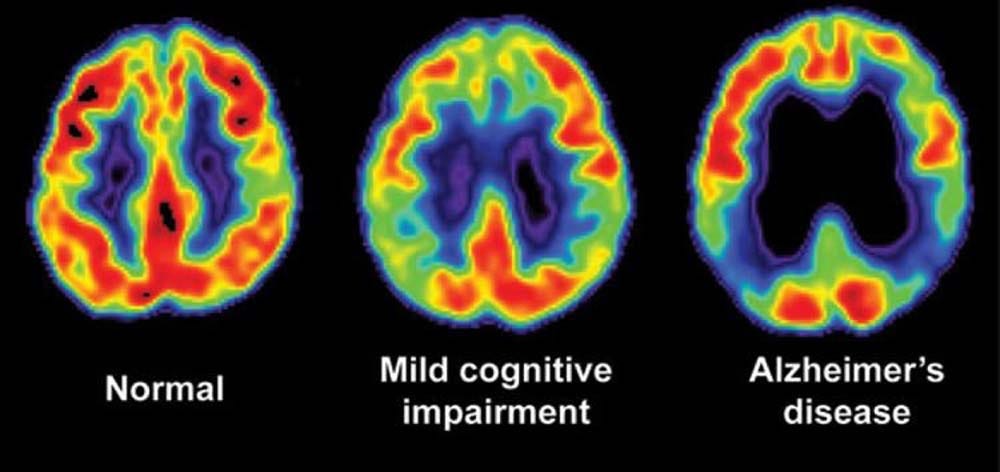 How Brain Therapy is Advancing Regenerative Medicine? | by Regenerative ...