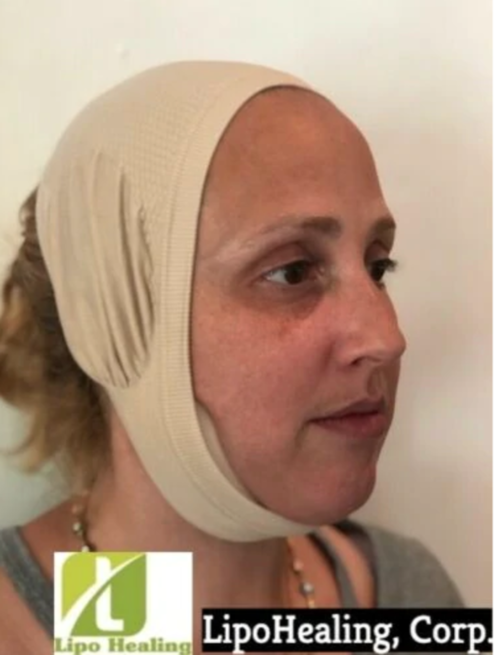 What is snoring chin strap ? - Facialstrap - Medium