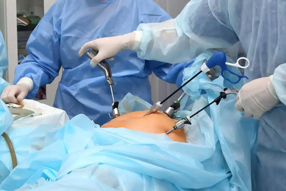 What is a laparoscopy?. Laparoscopy is a minimally invasive… | by ISHWA ...