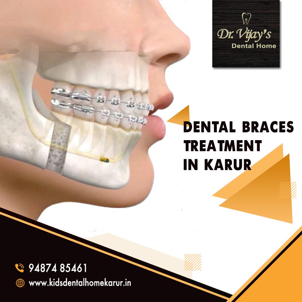 Know This !… When Do Your Kids Need Dental Braces? | by ...