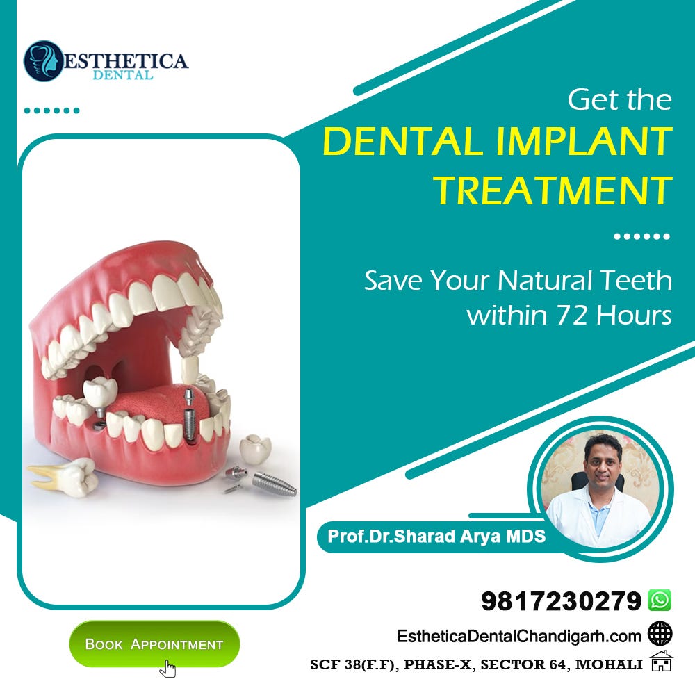 Enhance Your Smile with Dental Implants in Mohali ...
