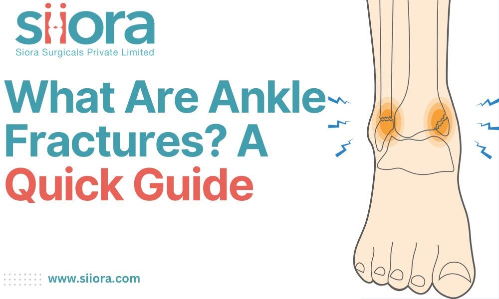 What Are Ankle Fractures? A Quick Guide - Siora surgical - Medium