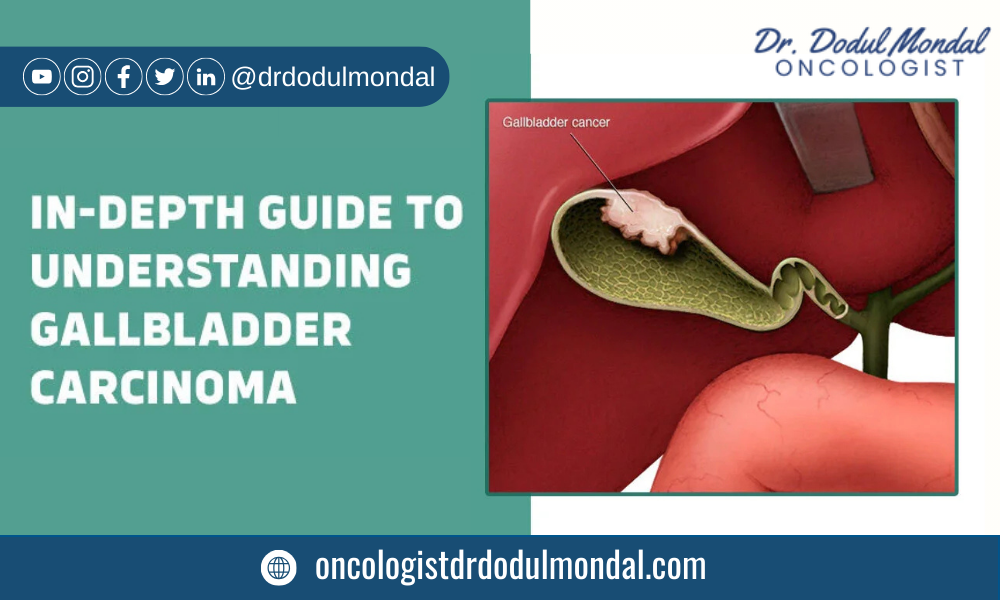 In-Depth Guide to Understanding Gallbladder Carcinoma | by Dr Dodul ...