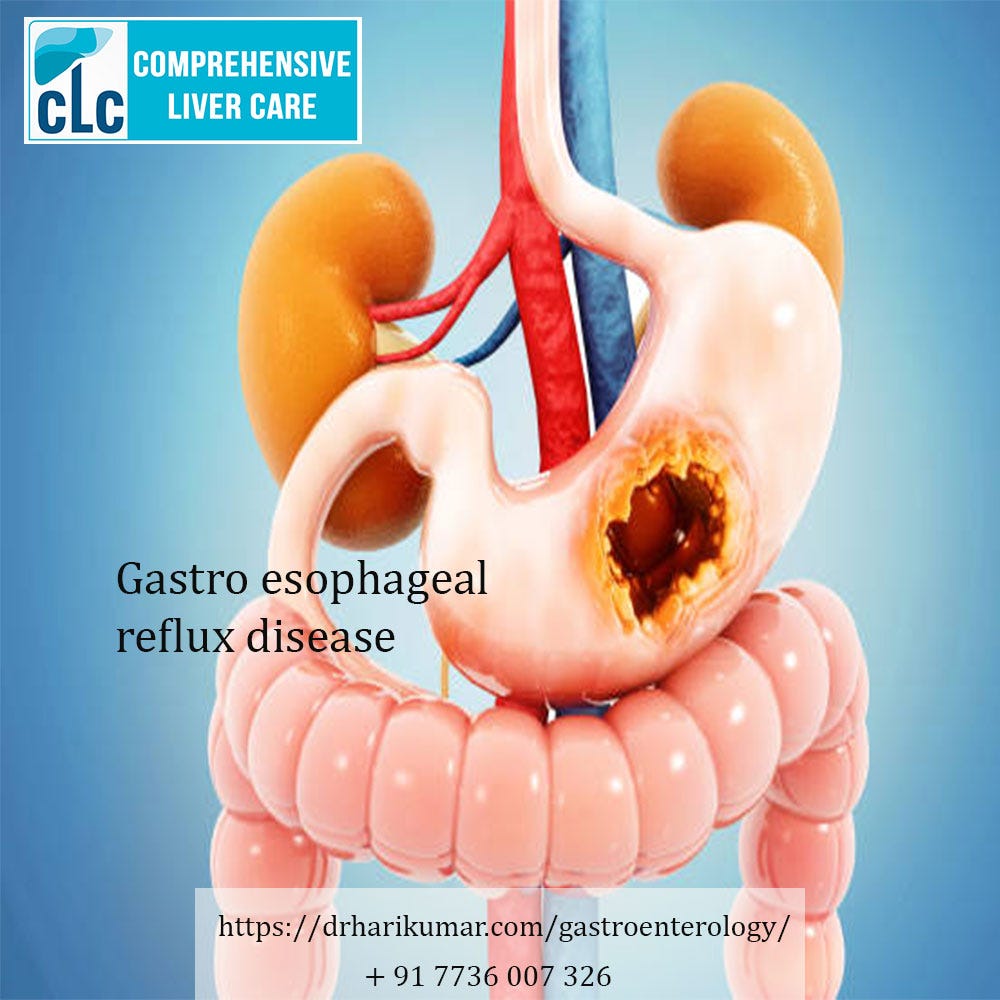 What is Gastroenterologist?. A gastroenterologist is a medical… | by ...