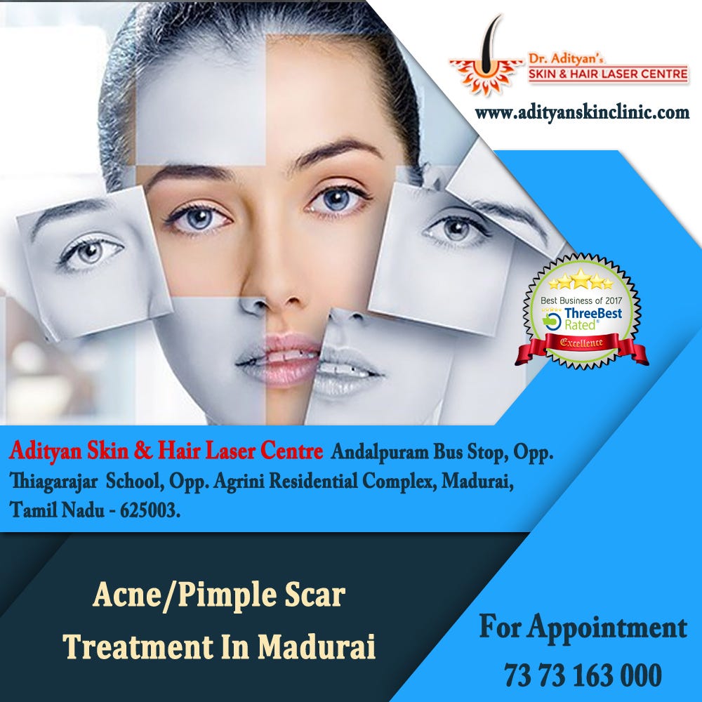Get rid of your Pimple problems by the specialists of Acne/Pimple Cure ...