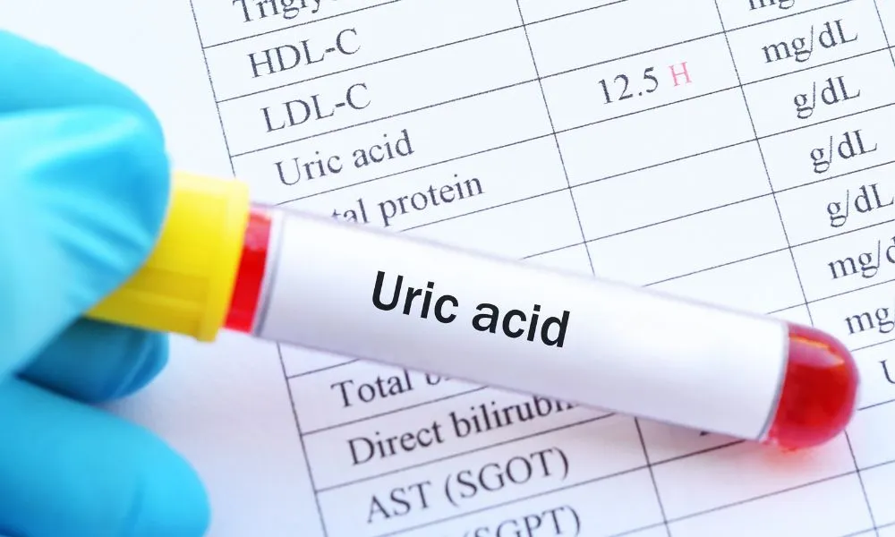 Uric Acid: Natural Ways to Control Health-Deteriorating Uric Acid | by ...