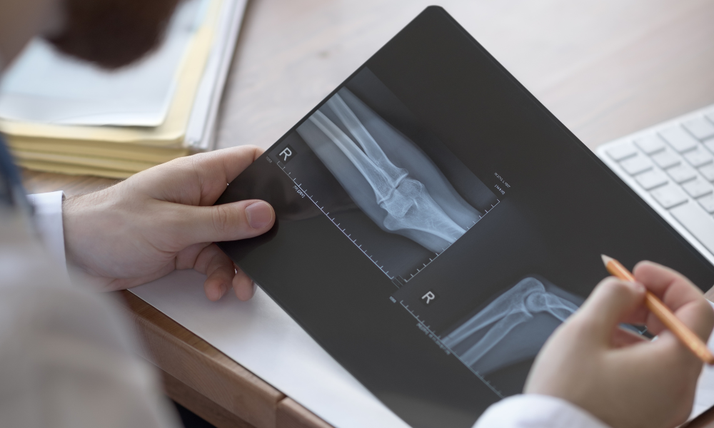 Mastering AP Elbow X-ray Interpretation: A Comprehensive Guide for ...