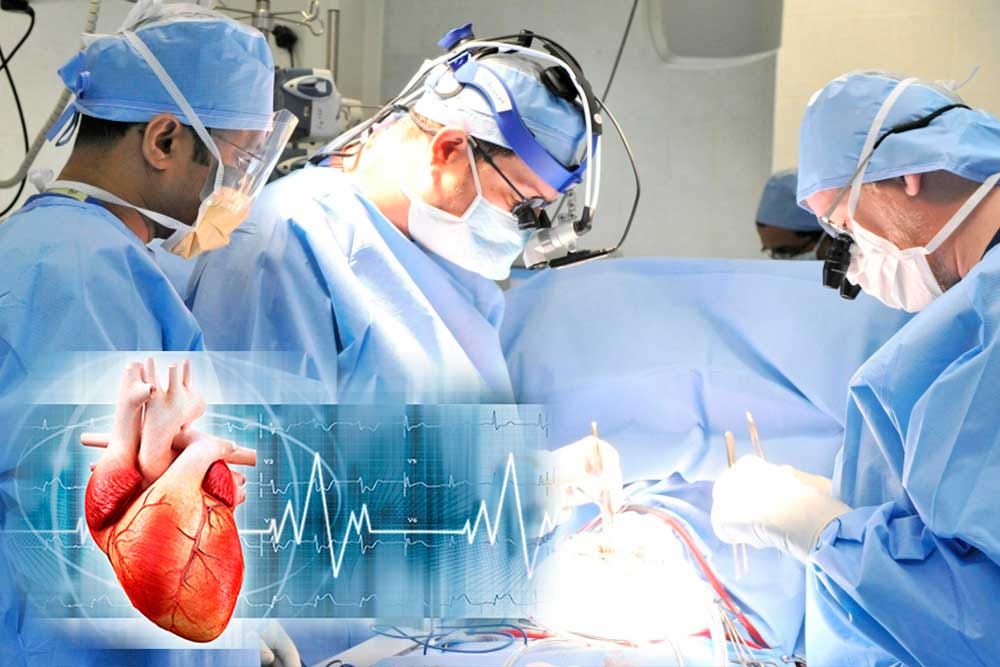 Coronary Artery Bypass Surgery: A Life-Saving Procedure to Restore ...