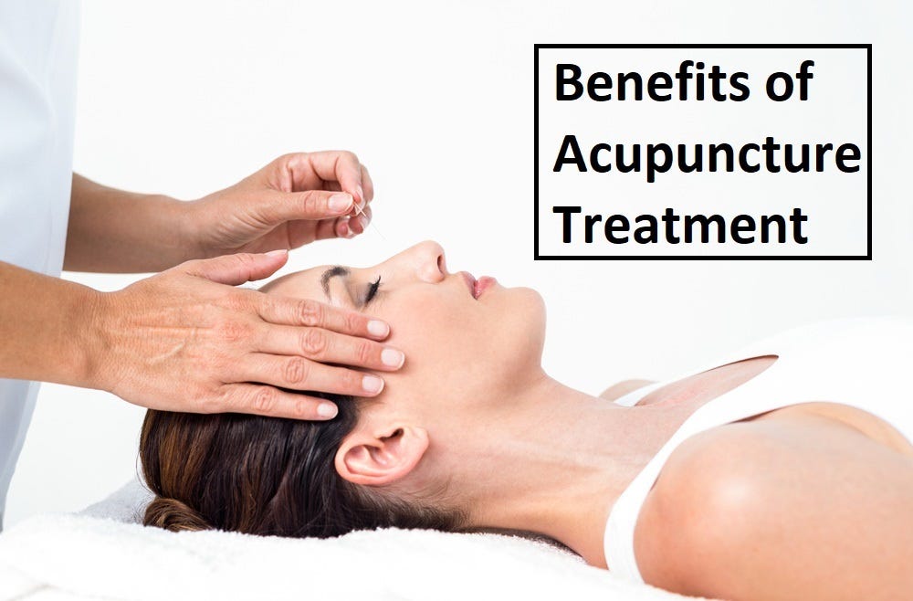 What is Acupuncture Treatment And What Are Its Benefits | by Local ...