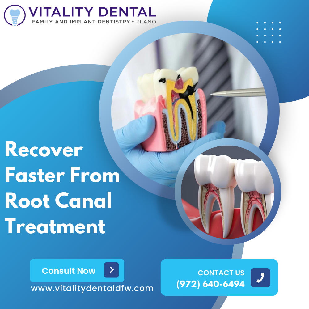 Swift Recovery: Essential Tips for Healing After Root Canal Treatment ...