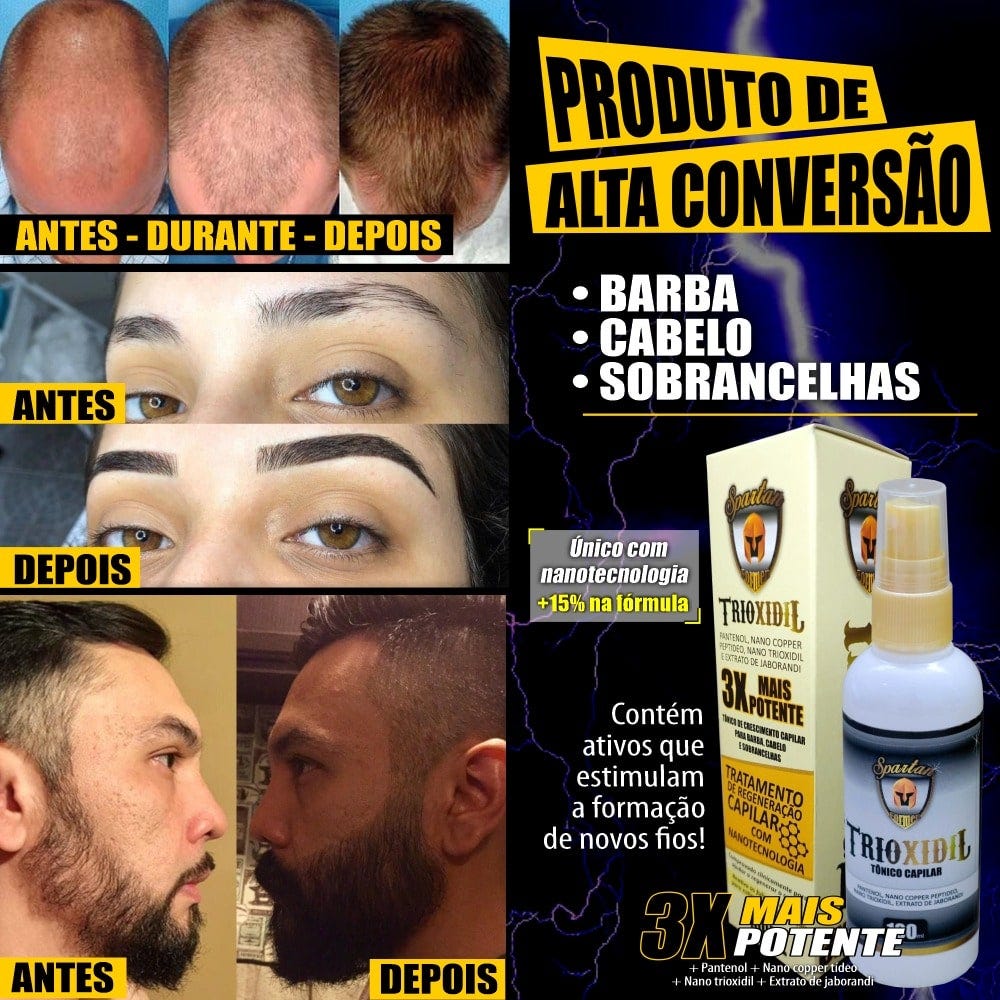O Trioxidil 15% é um complexo nutritivo de tripla ação, com ...