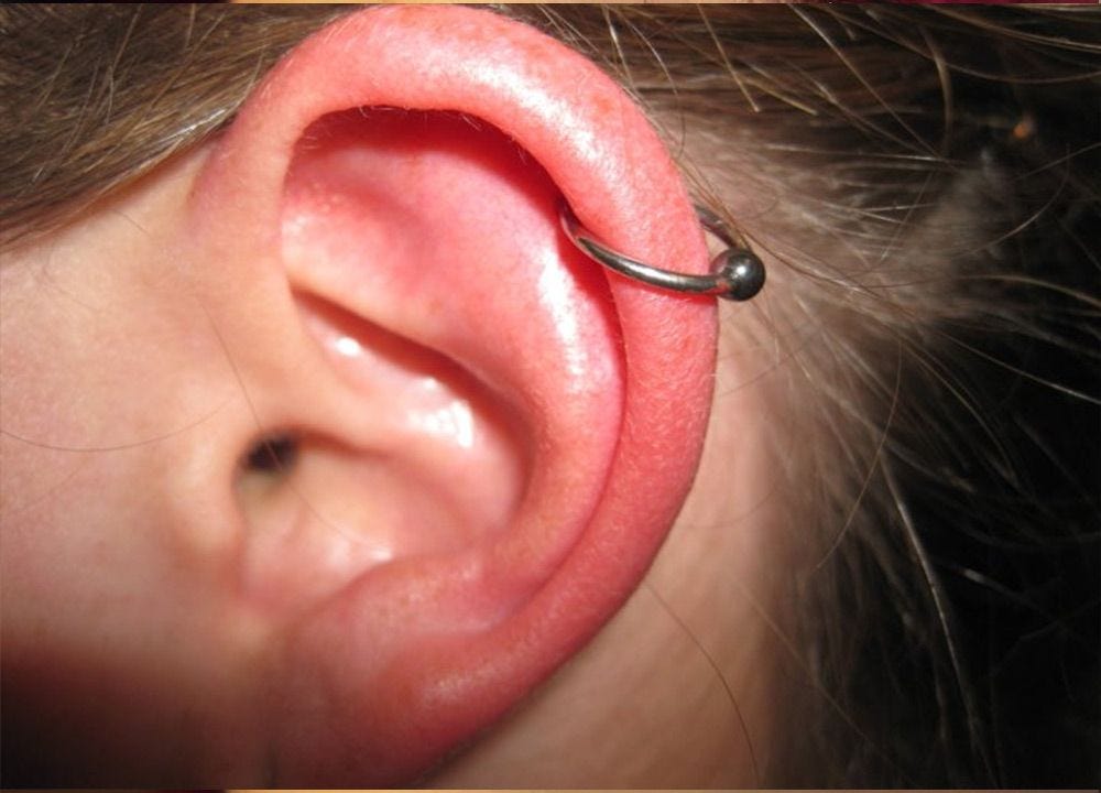 The Ultimate Guide to Cartilage Piercing | by TheVoiceOfWoman | Medium