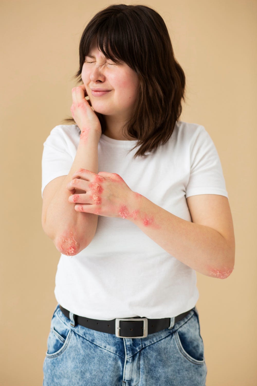 Yeast Infection When Period Starts