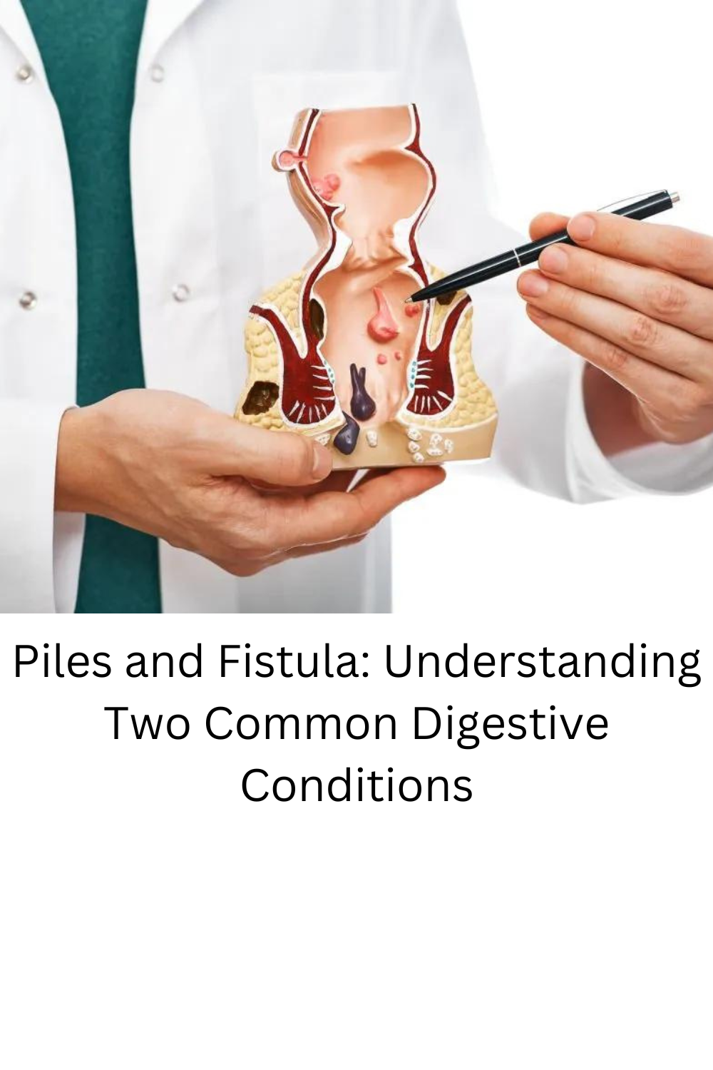 Piles and Fistula: Understanding Two Common Digestive Conditions | by ...