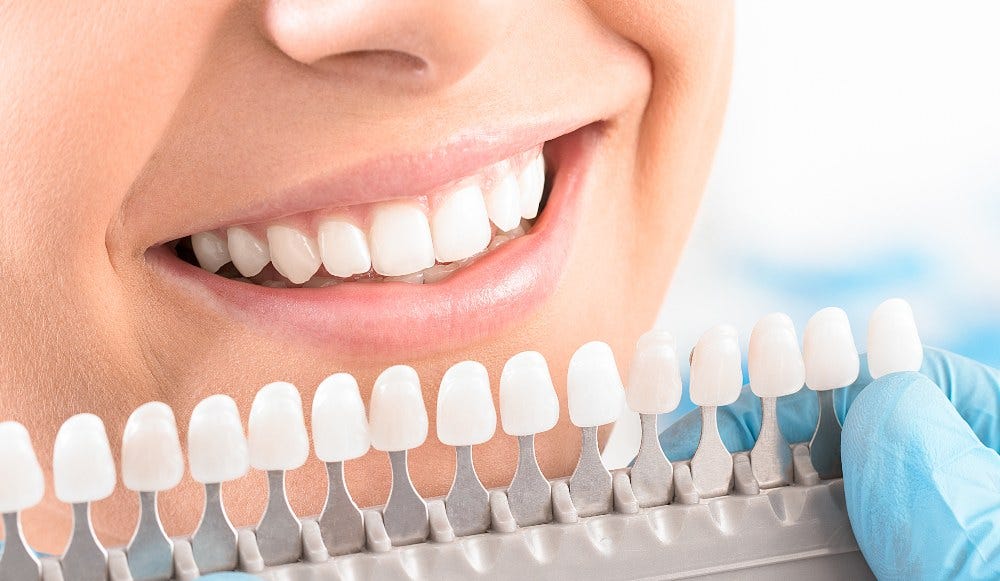 Teeth Whitening Market Forecast and Statistics, Growth Prospective ...