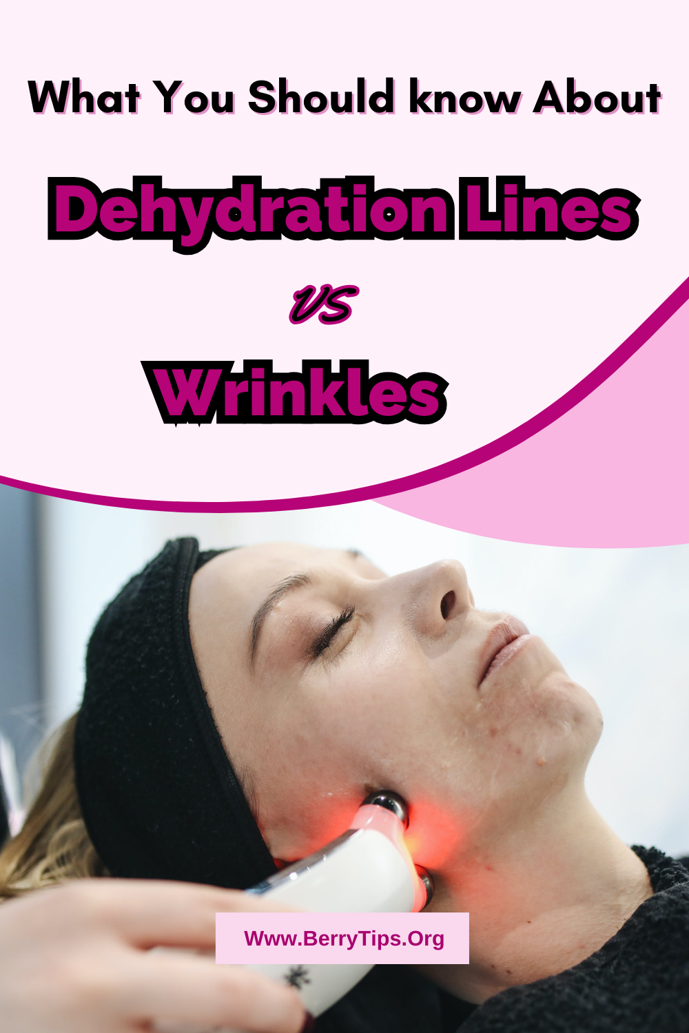 Dehydration Lines vs. Wrinkles: What You Should Know | by BerryTips.Org | Feb, 2024 | Medium
