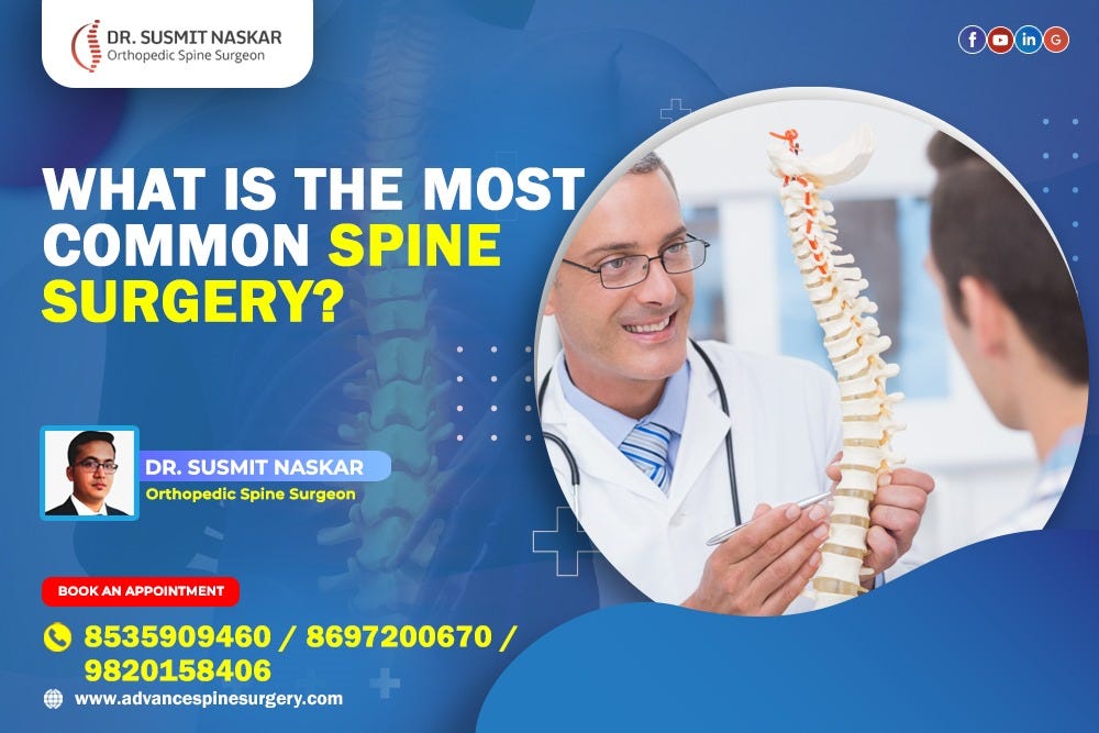 What is the most common spine surgery? | by Creatorssky | Medium