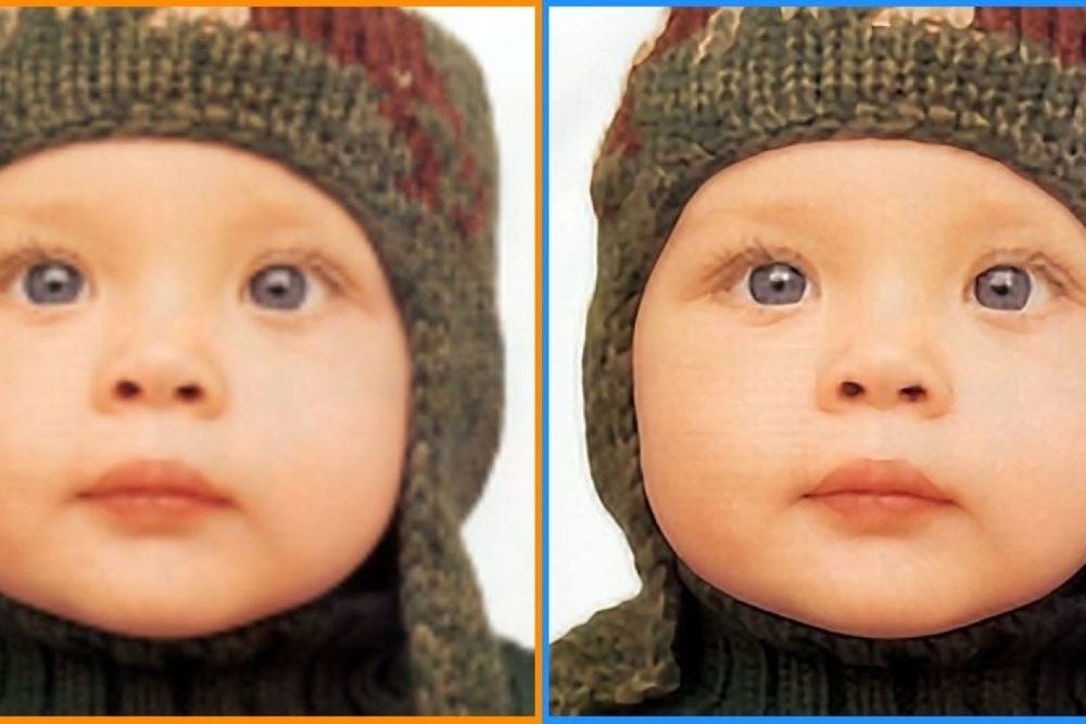 Single Image Super-Resolution in Deep Learning: CNN and Transformer | by Shanghua Liu | Medium