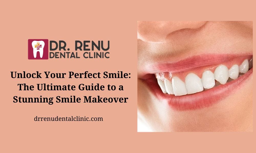 Unlock Your Perfect Smile: The Ultimate Guide to a Stunning Smile ...
