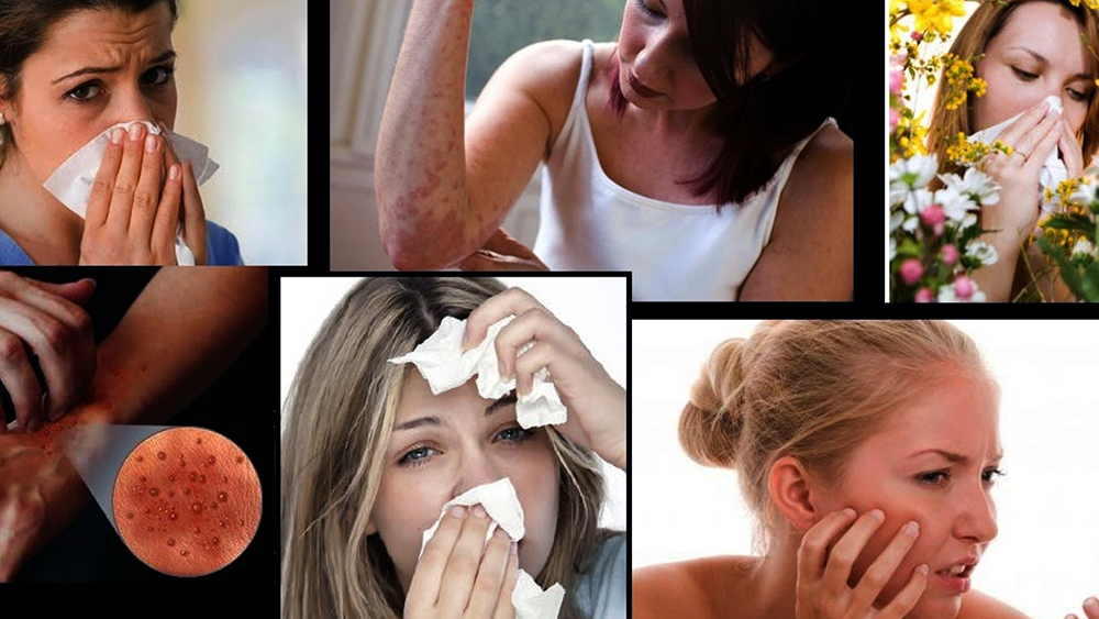 Allergic Reactions: Identifying, Reacting, and Keeping Cool | by The ...