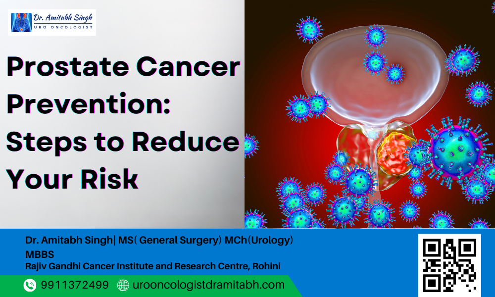 Prostate Cancer Prevention: Steps to Reduce Your Risk ...