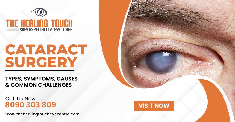 Cataract Surgery: Types, Symptoms, Causes & Common Challenges | by ...