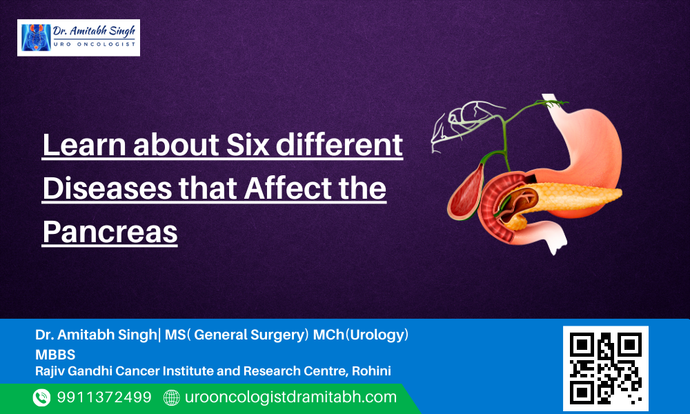 Learn about Six Different Diseases that Affect the Pancreas | by ...