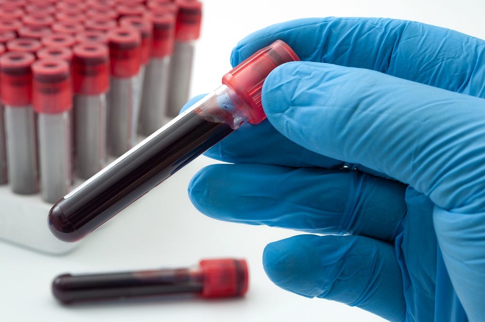 Phlebotomy Technician Program Los Angeles - NIU College - Medium