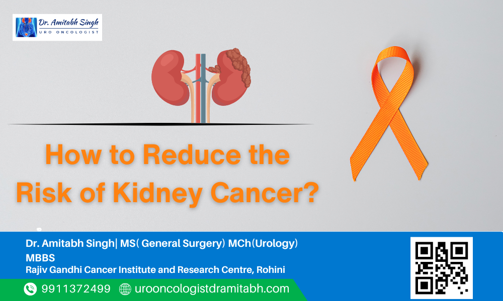 How to Reduce the Risk of Kidney Cancer? - Urooncologistdramitabh - Medium