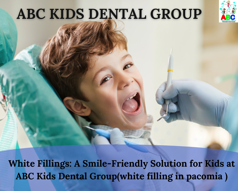 (white filling in Pacoima )White Fillings: A Smile-Friendly Solution ...