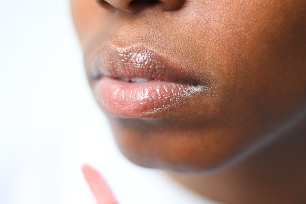 How to Get Rid of Black Lips: Causes and Remedies | by Silverstreak ...