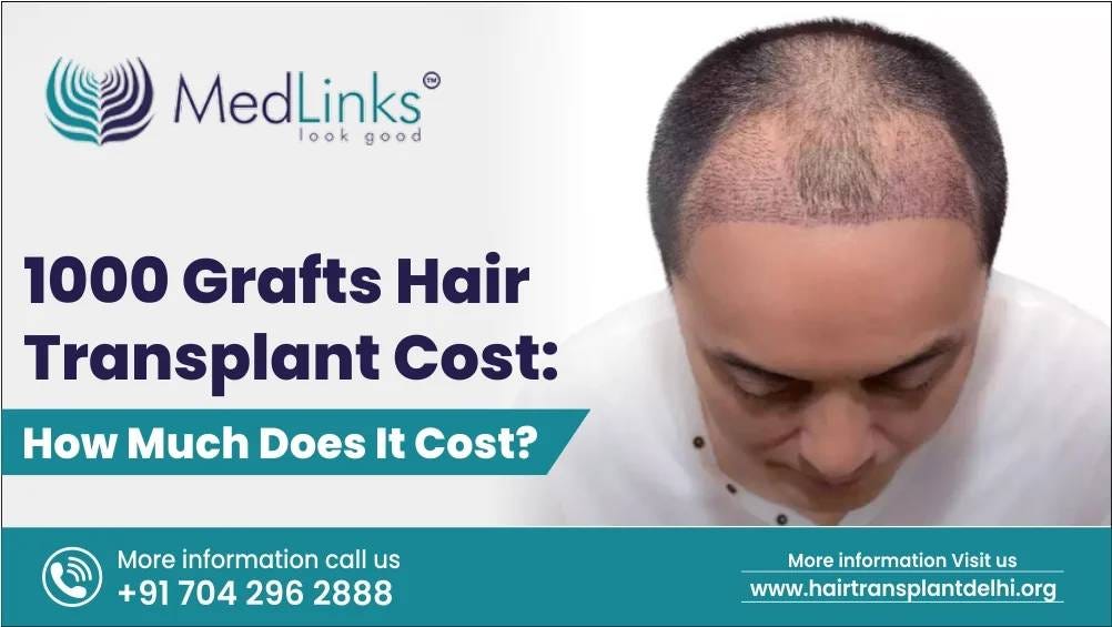 Understanding the Cost of 1000 Grafts Hair Transplant: Factors and ...
