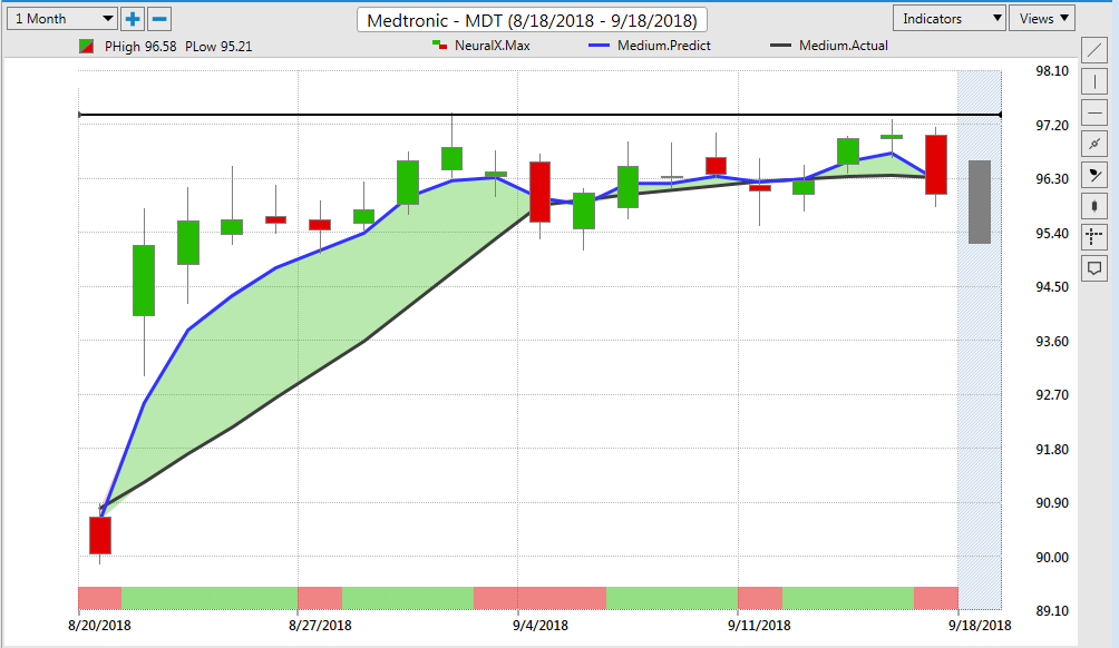 MDT Stock — Medtronic Trading Journal with VantagePoint | by ...
