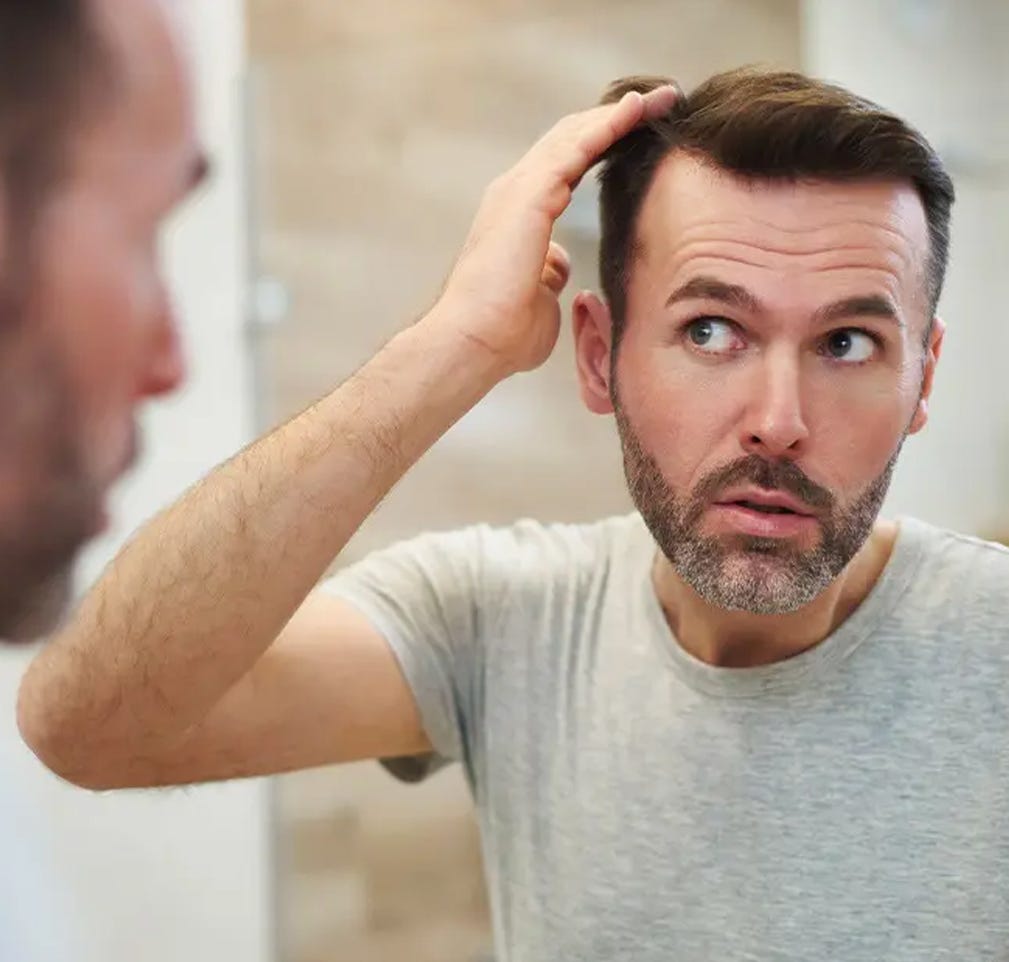 Understanding Widow’s Peak: Causes and What it Means for You | Medium