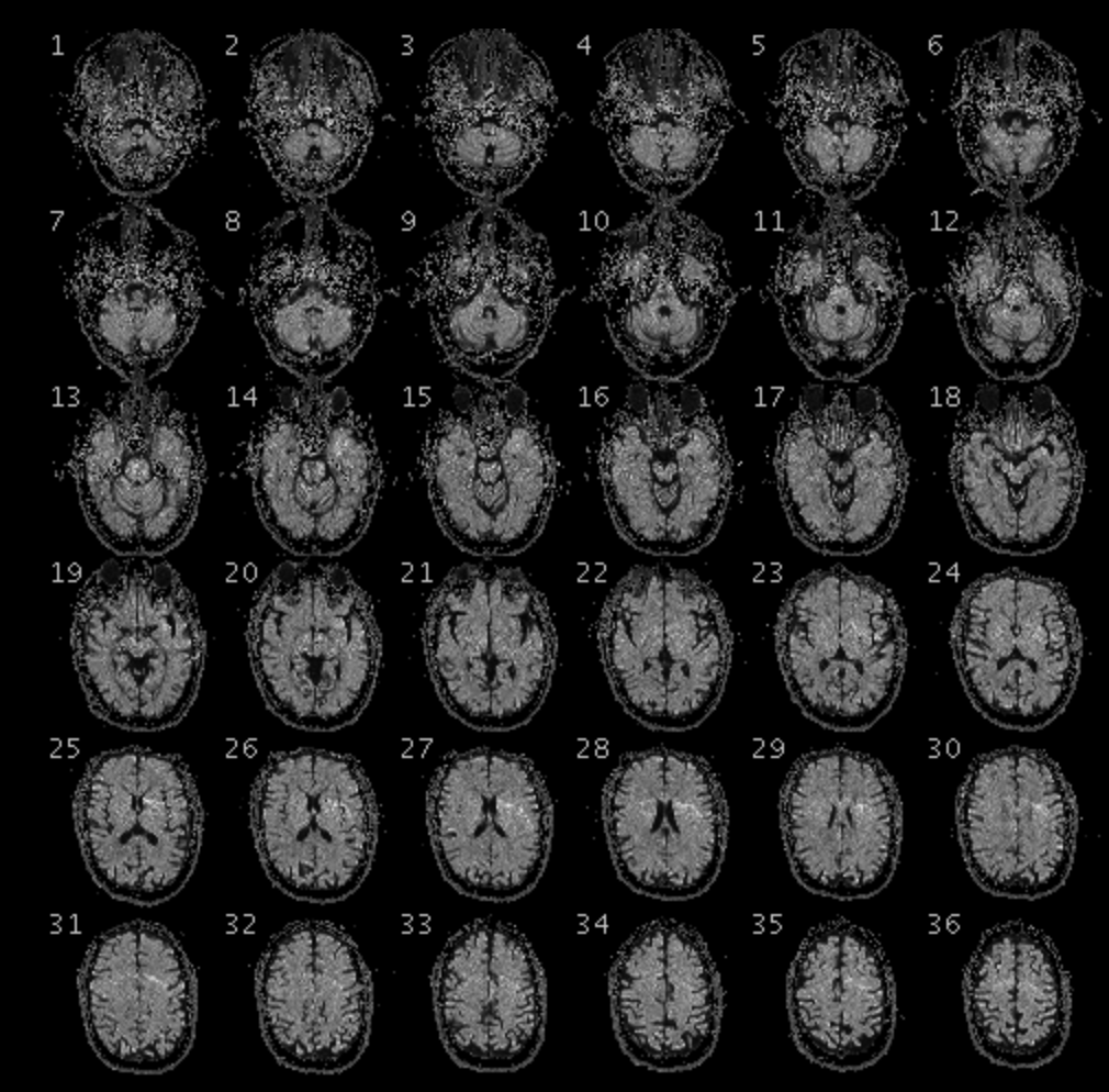 Deciphering cognitive processes using NeuroImaging(Computational NeuroScience) | by Sumanth S ...