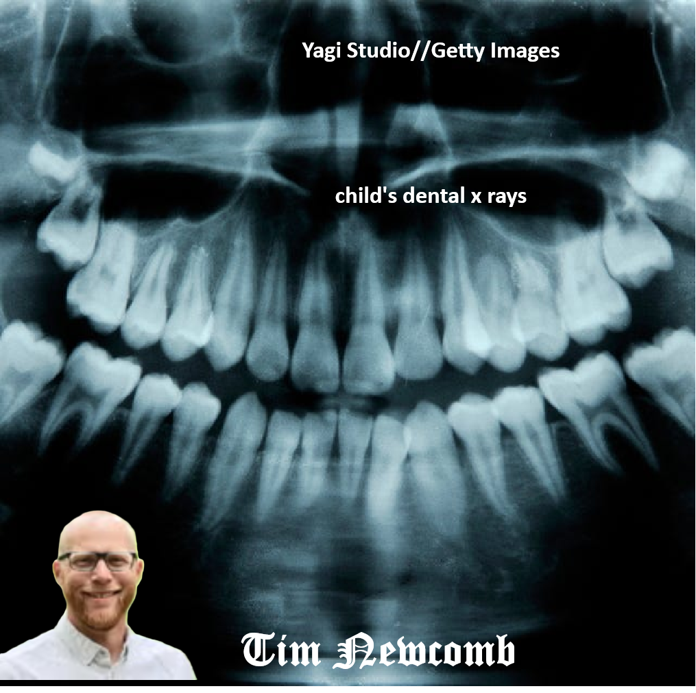 Humans Have a Third Set of Teeth. New Medicine May Help Them Grow. | by ...