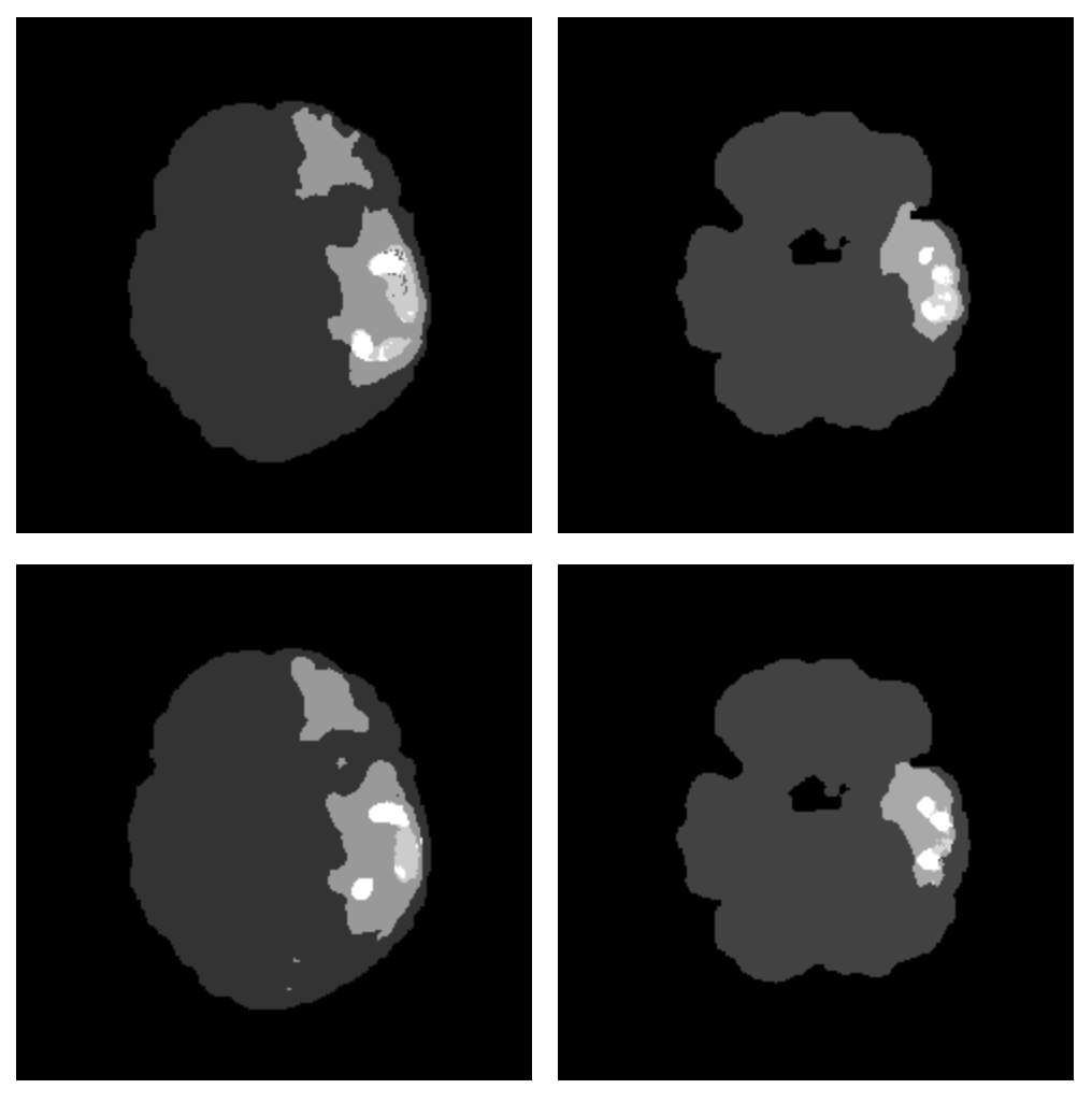 Handling Unbalanced Data in Deep Image Segmentation | by dong chen | Medium