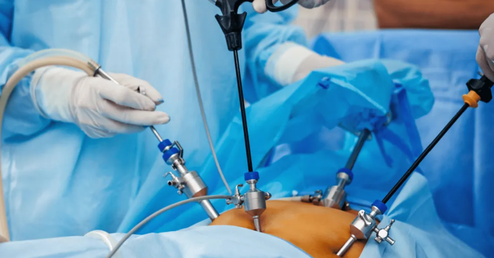 Criteria of a Good Laparoscopy Training Institute | by Laparoscopic ...