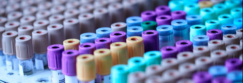 ELISA Kits. The elisa kit company Shanghai Bluegene… | by ...