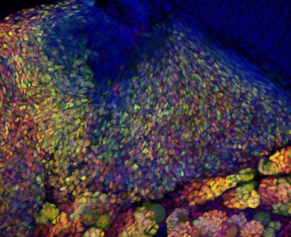 A fluorescent timer. Researchers have developed a new tool… | by eLife ...