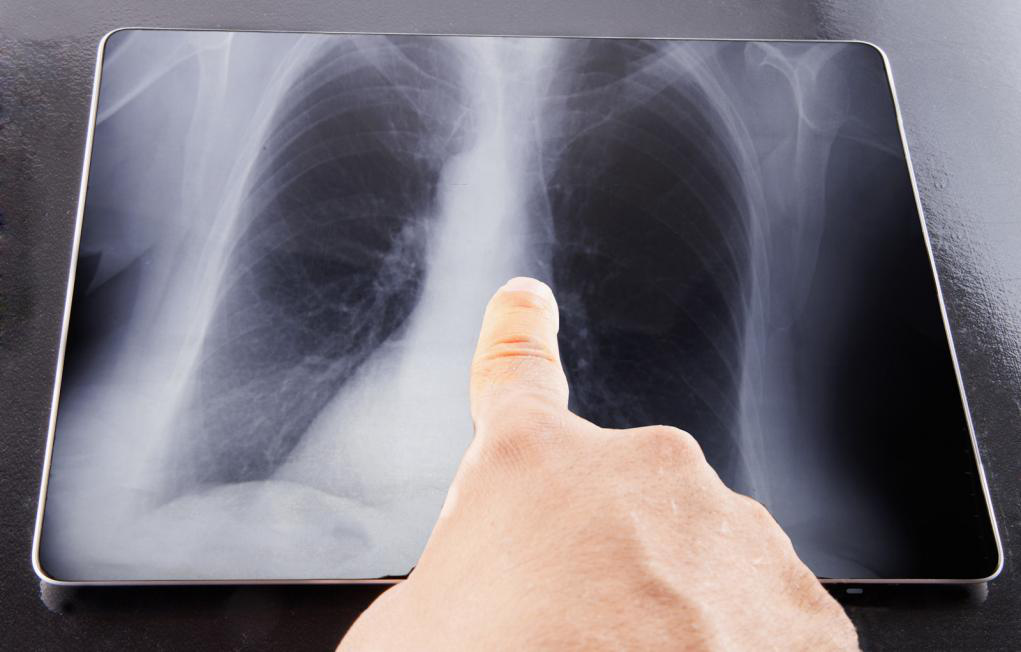 Digital X-Ray Advantages Your Practice Can’t Afford to Ignore — Digital ...